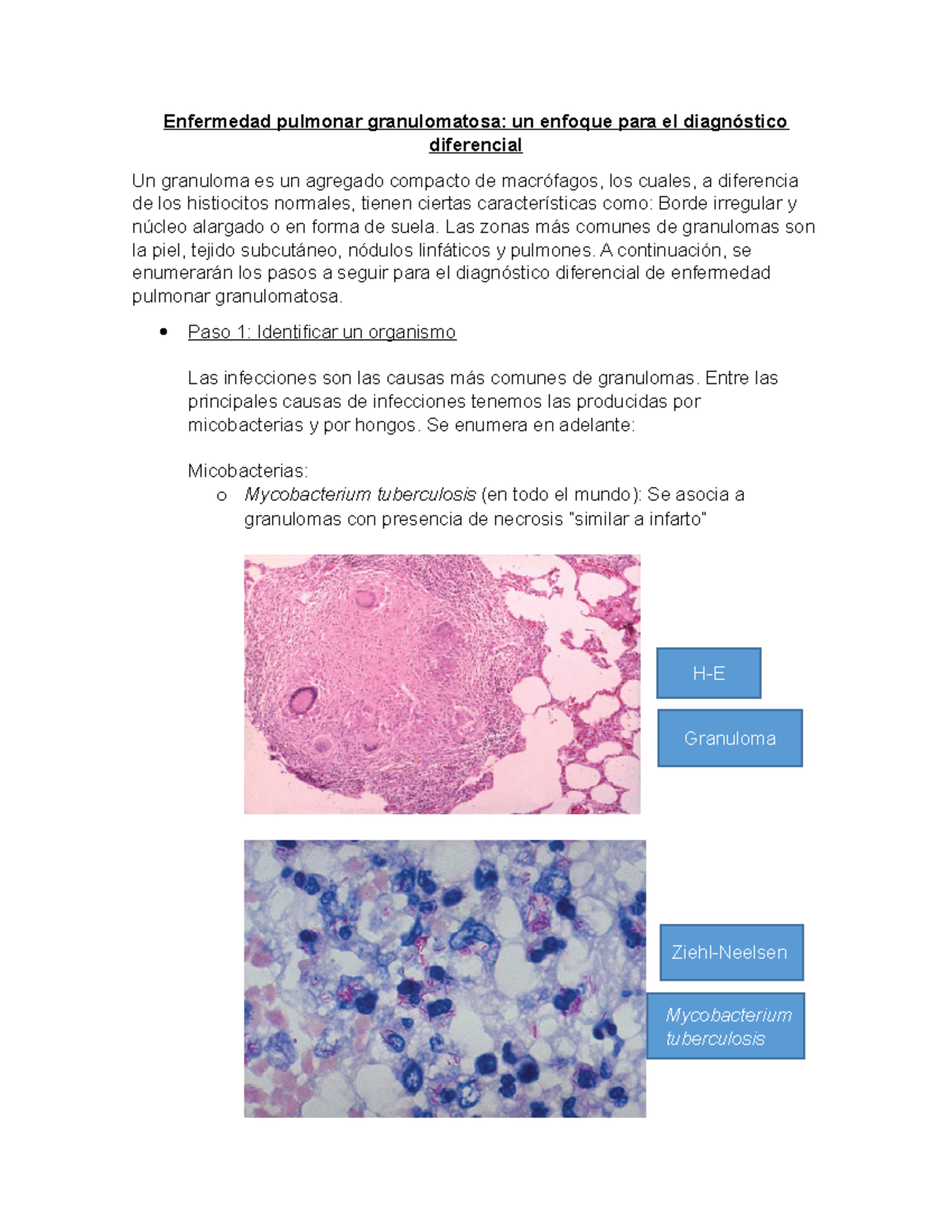 Enfermedad pulmonar granulomatos JD - Las zonas más comunes de ...