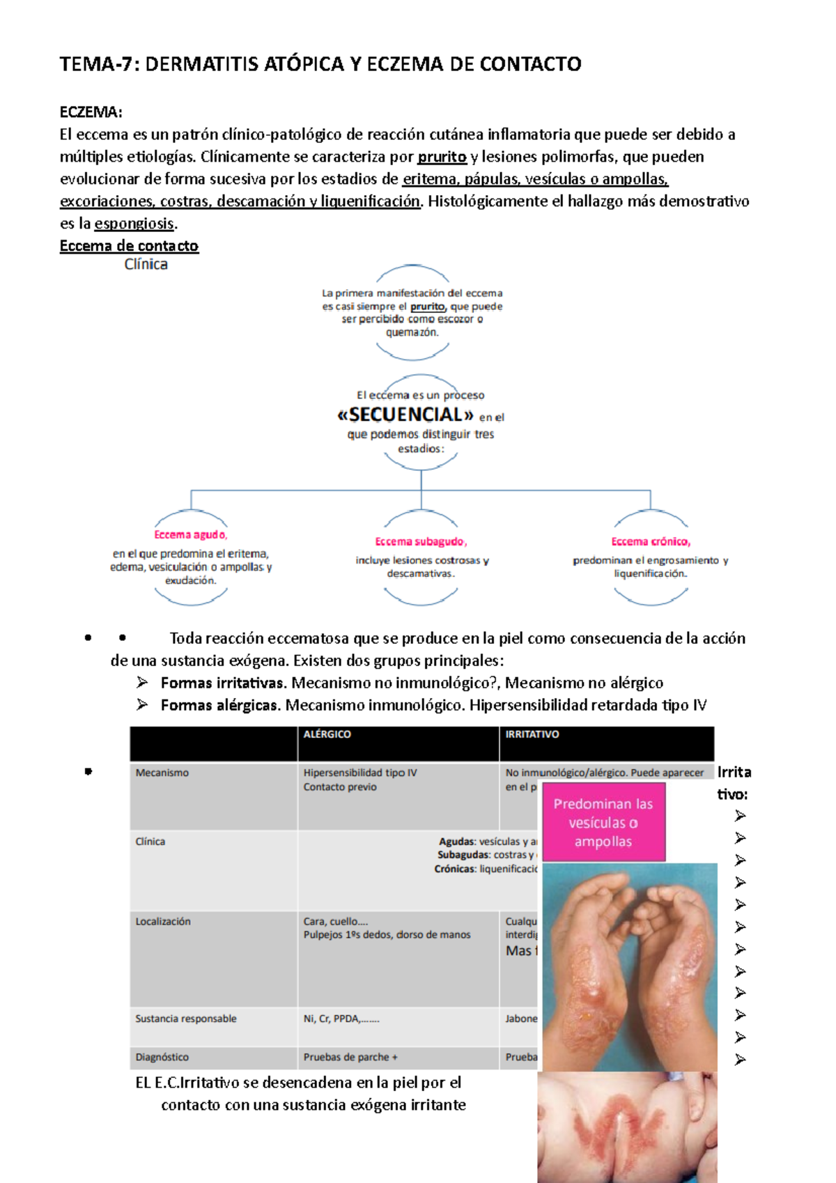TEMA 7. Eczema y dermatitis atópica - TEMA-7: DERMATITIS ATÓPICA Y ...