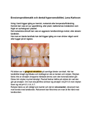 Cariologi tenta frågor - Cariologi tenta frågor Beskriv skillnaden ...