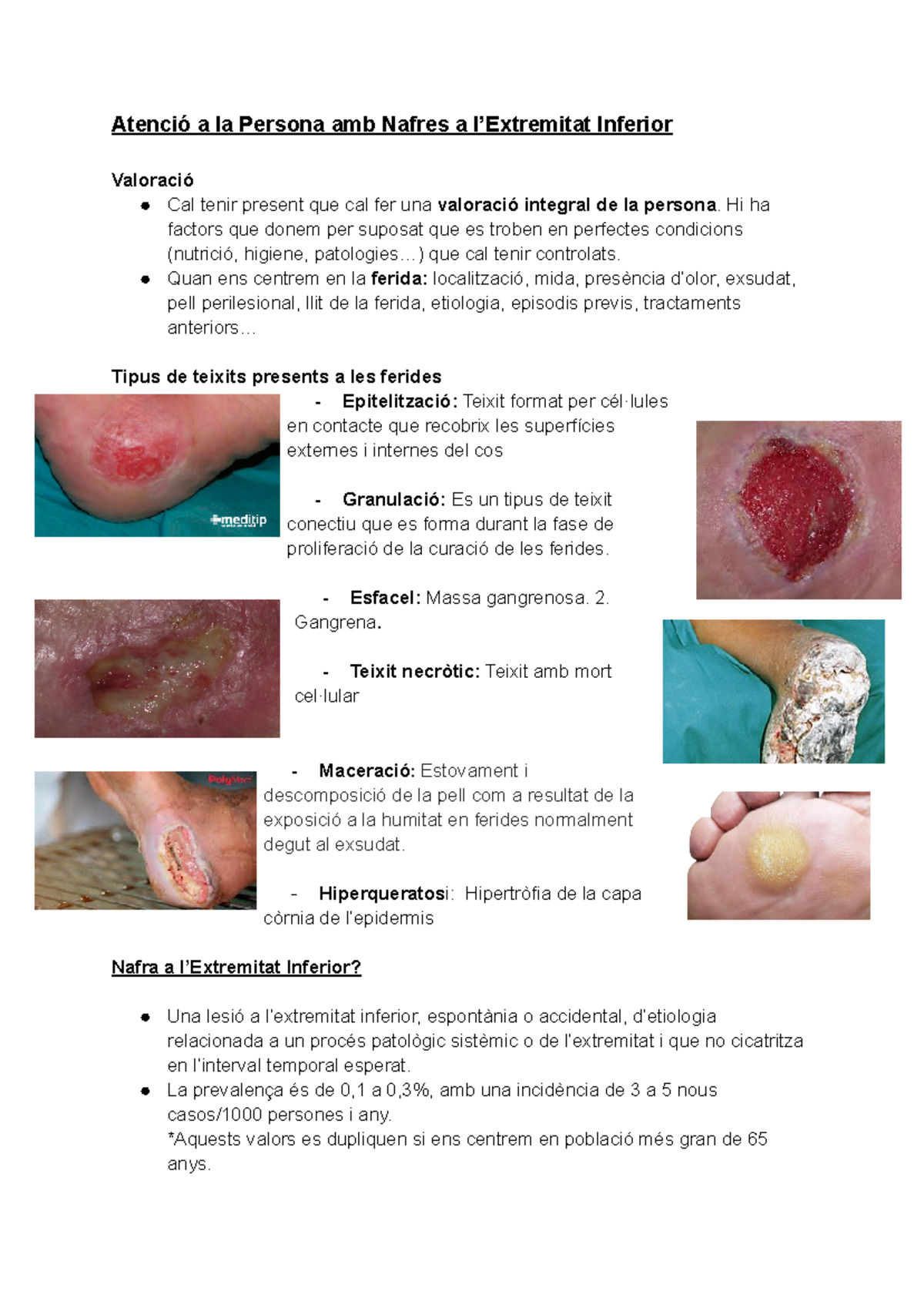 Atenció a la Persona amb Nafres a l’Extremitat Inferior - Atenció a la ...