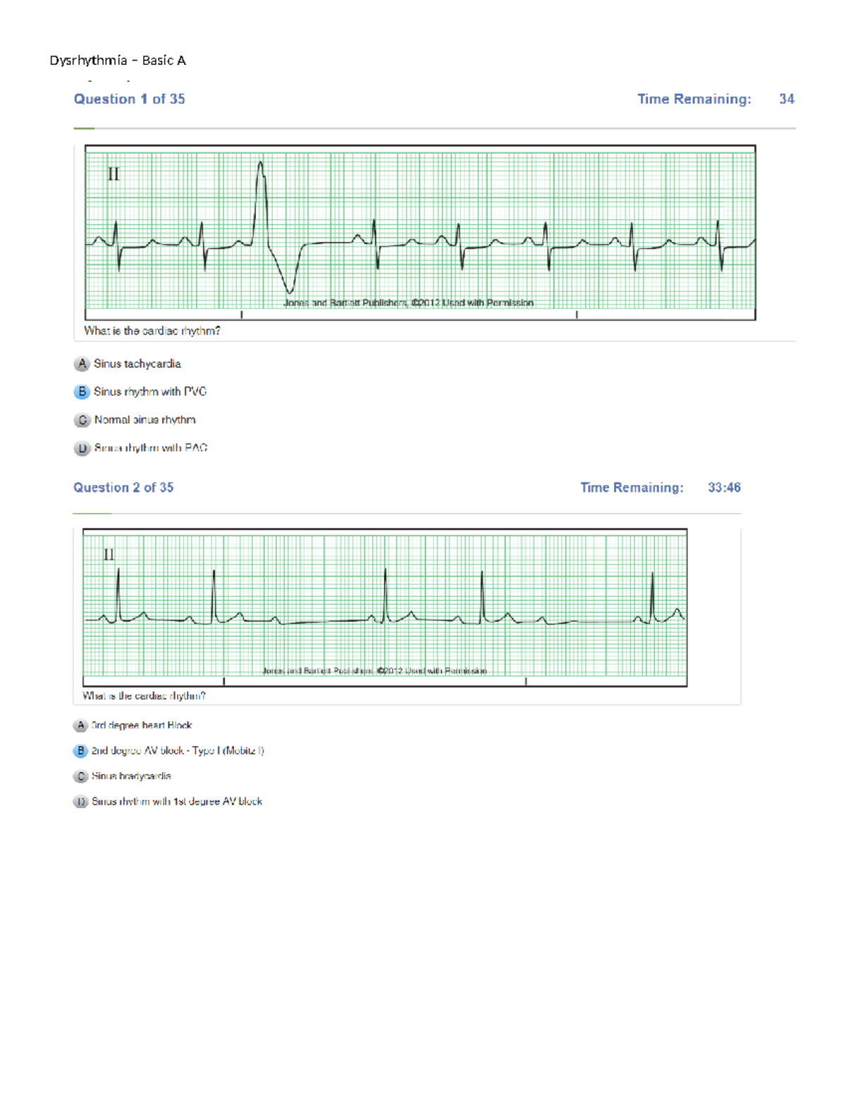 Dysrhythmia - Telemetry exam - 101 - Dysrhythmia – Basic A - Studocu