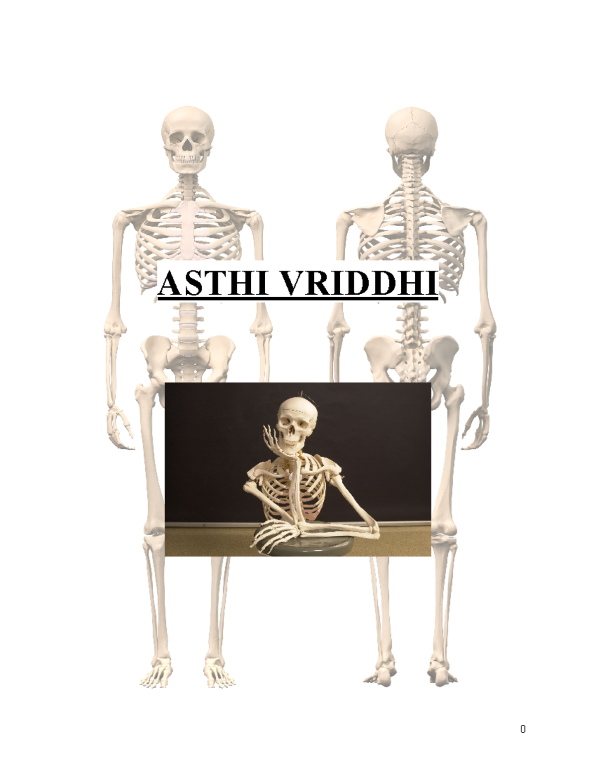 Asthi Vriddhi - Summary Swasthavritta - ASTHI VRIDDHI Name : Srishti ...