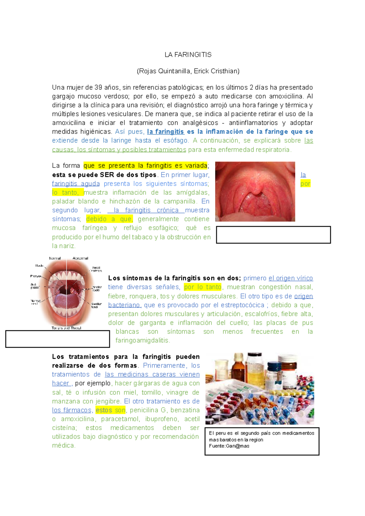 LA Faringitis - farimgitis producto academico - LA FARINGITIS (Rojas ...