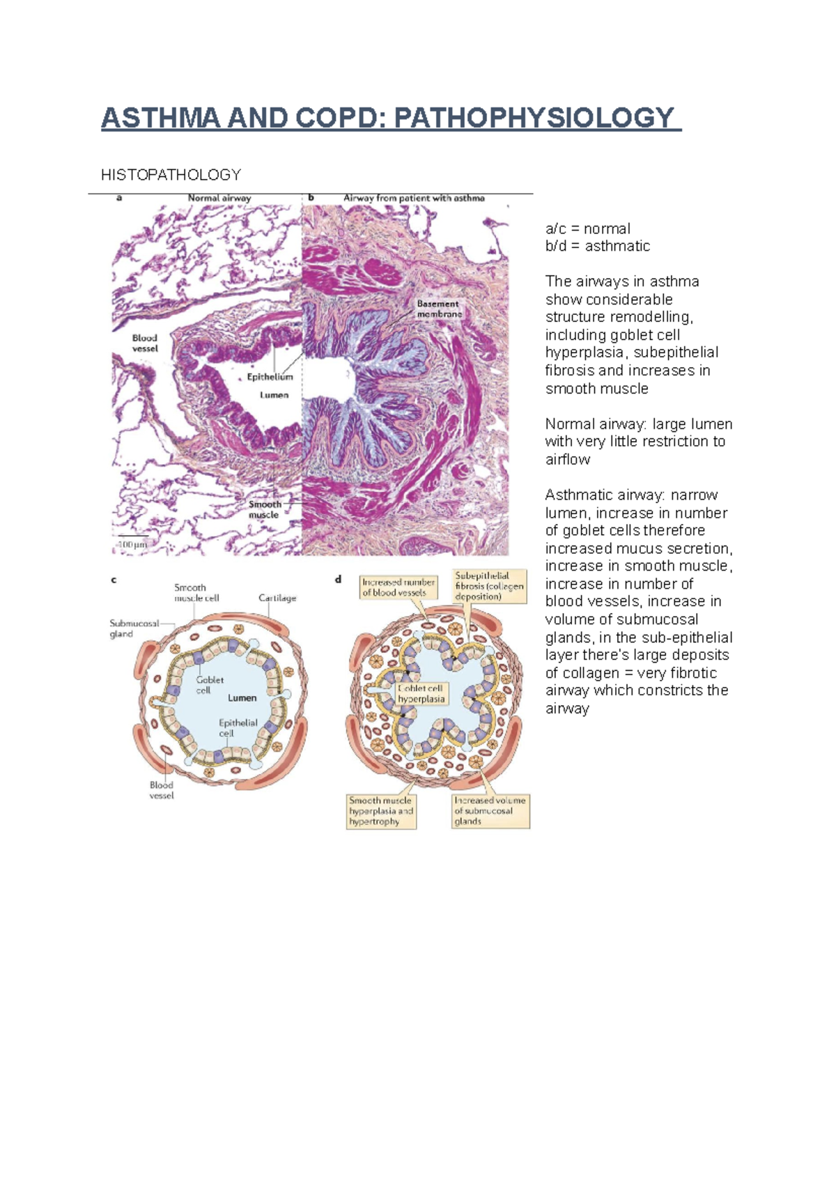 Asthma AND COPD - Pathophysiology - ASTHMA AND COPD: PATHOPHYSIOLOGY ...