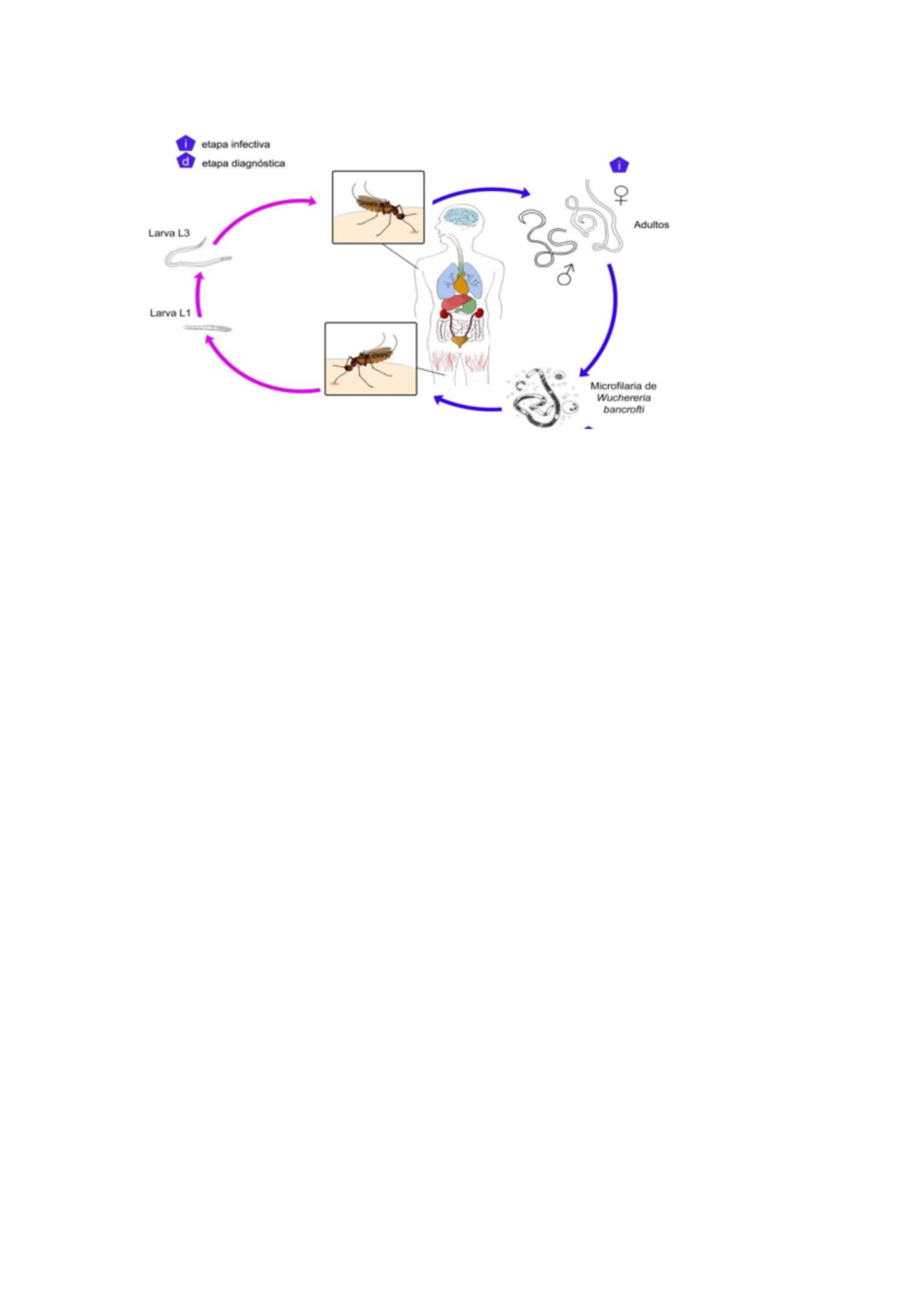 Filariasis Linfática - desequilibrio - Patologia en la arquitectura ...