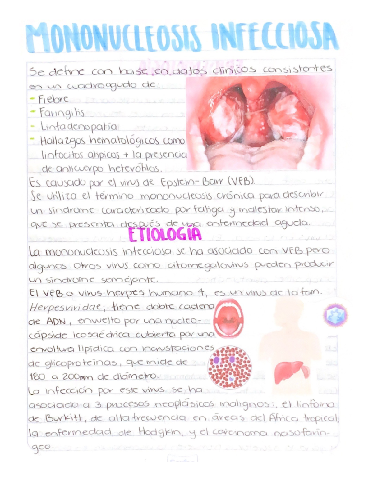 Mononucleosis Infecciosa - Epidemiología - UAT - Studocu