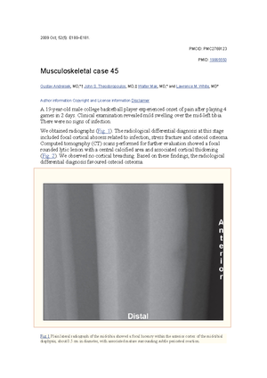 Peritonitis Case Study - Malawi Medical Journal; 25(3): 86-87 September 2013 Severe Peritonitis ...