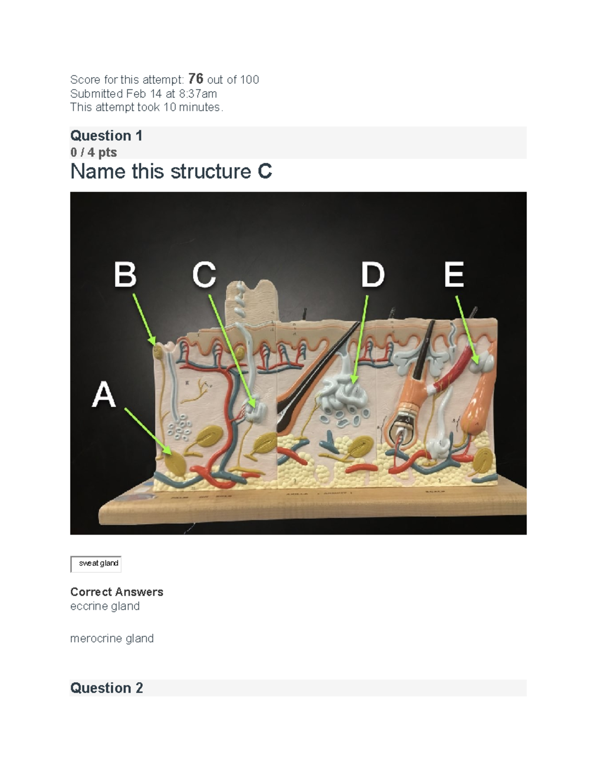 Integumentary quiz (lab) - Score for this attempt: 76 out of 100 ...