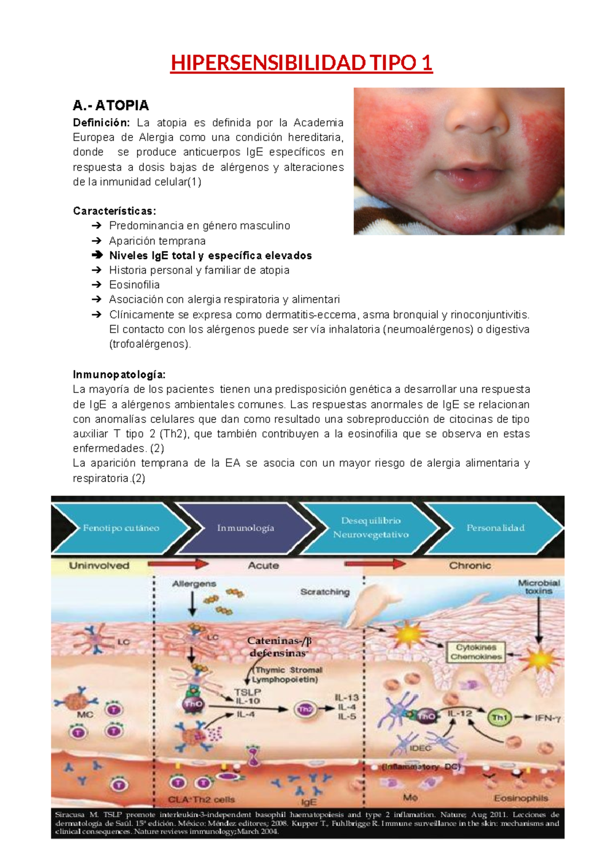 Enfermedades de tipos de hipersensibilidad - HIPERSENSIBILIDAD TIPO 1 A ...