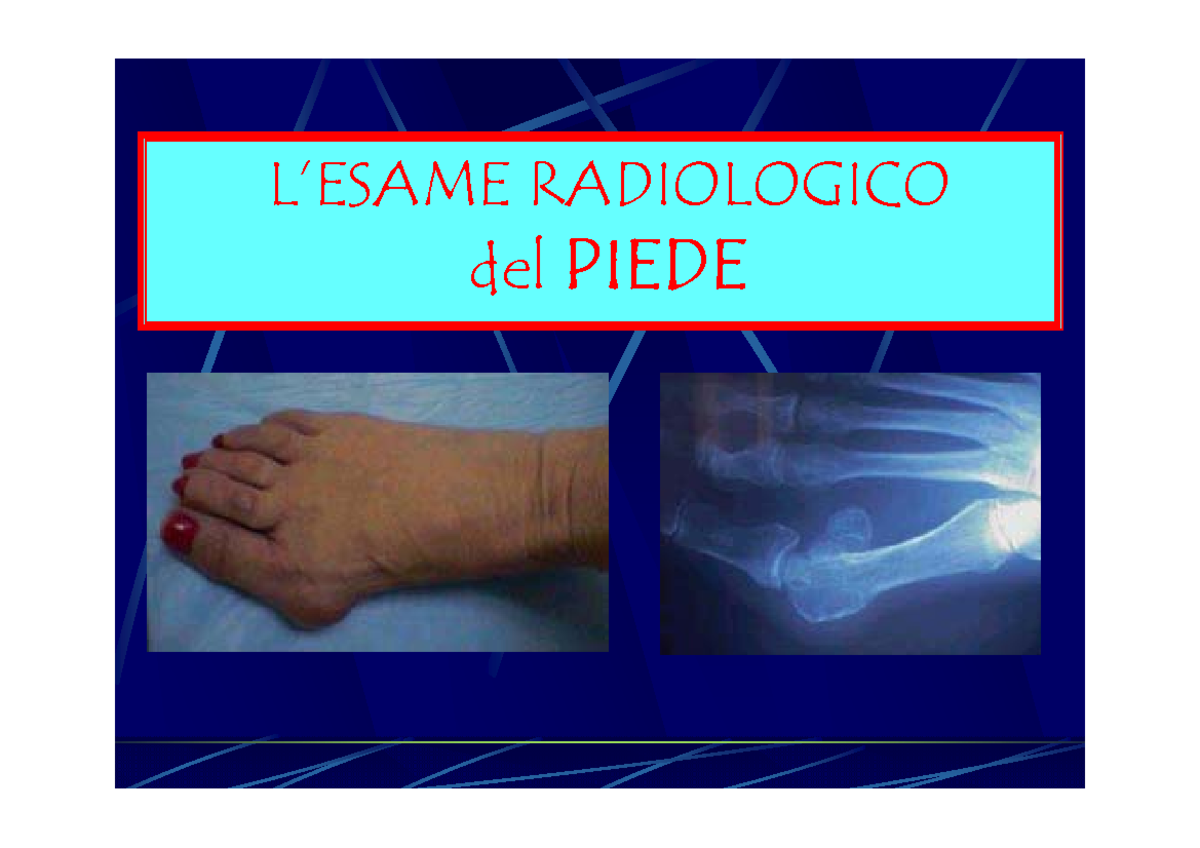 231-019-20 Rx piede - 2w\efrgh - L’ESAME RADIOLOGICO del PIEDE ...