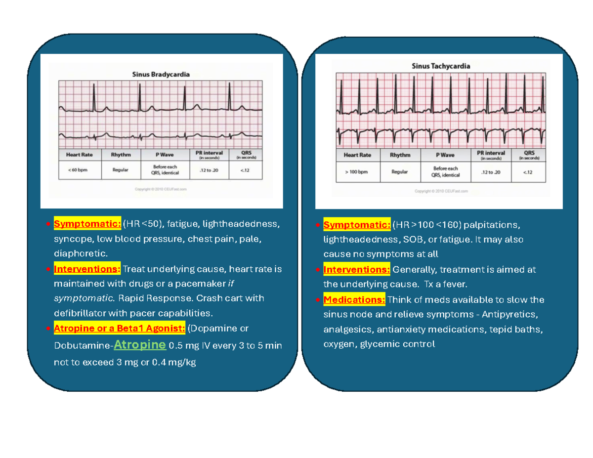 Perfusion Rhythms - Symptomatic: (HR