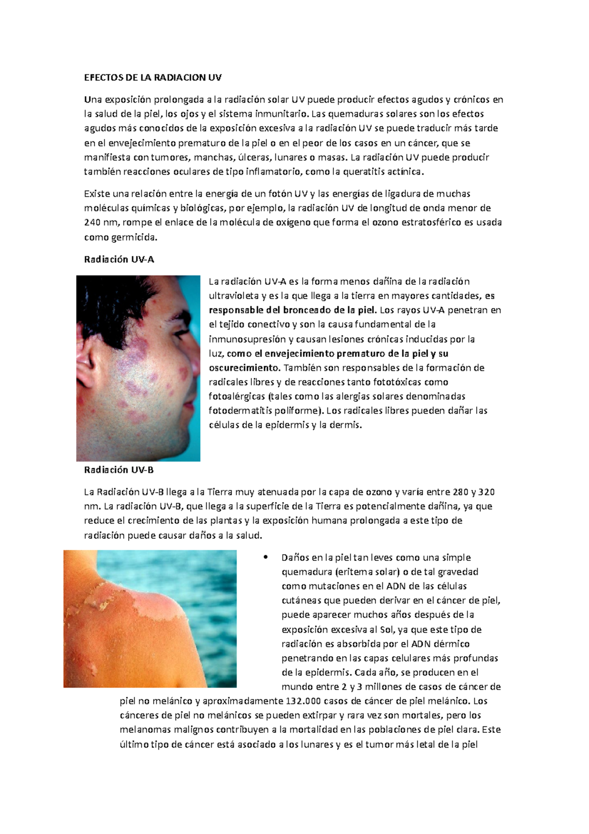 Efectos DE LA Radiacion UV - EFECTOS DE LA RADIACION UV Una exposición ...