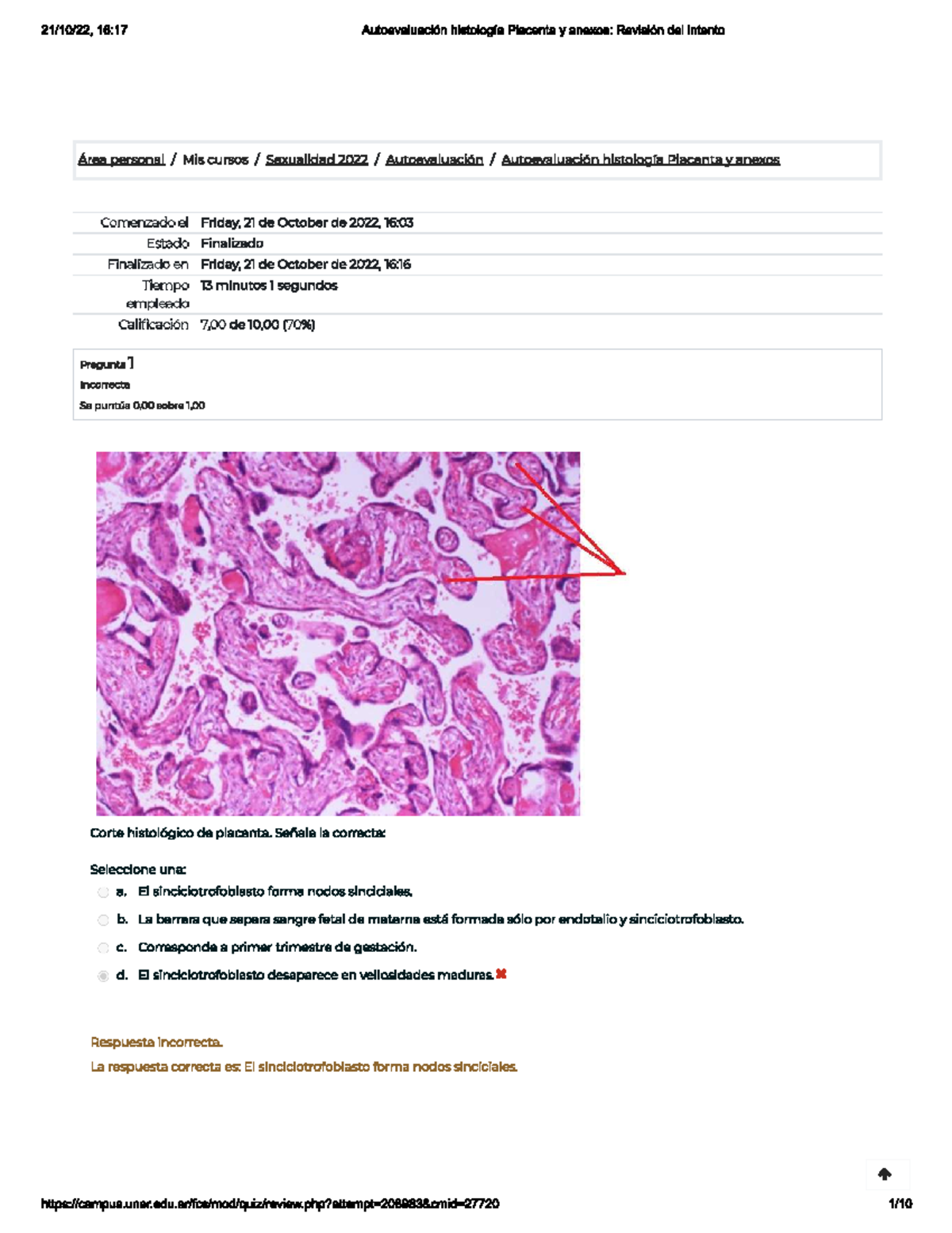 Histo placenta - Sexualidad, genero y reproducción - Studocu