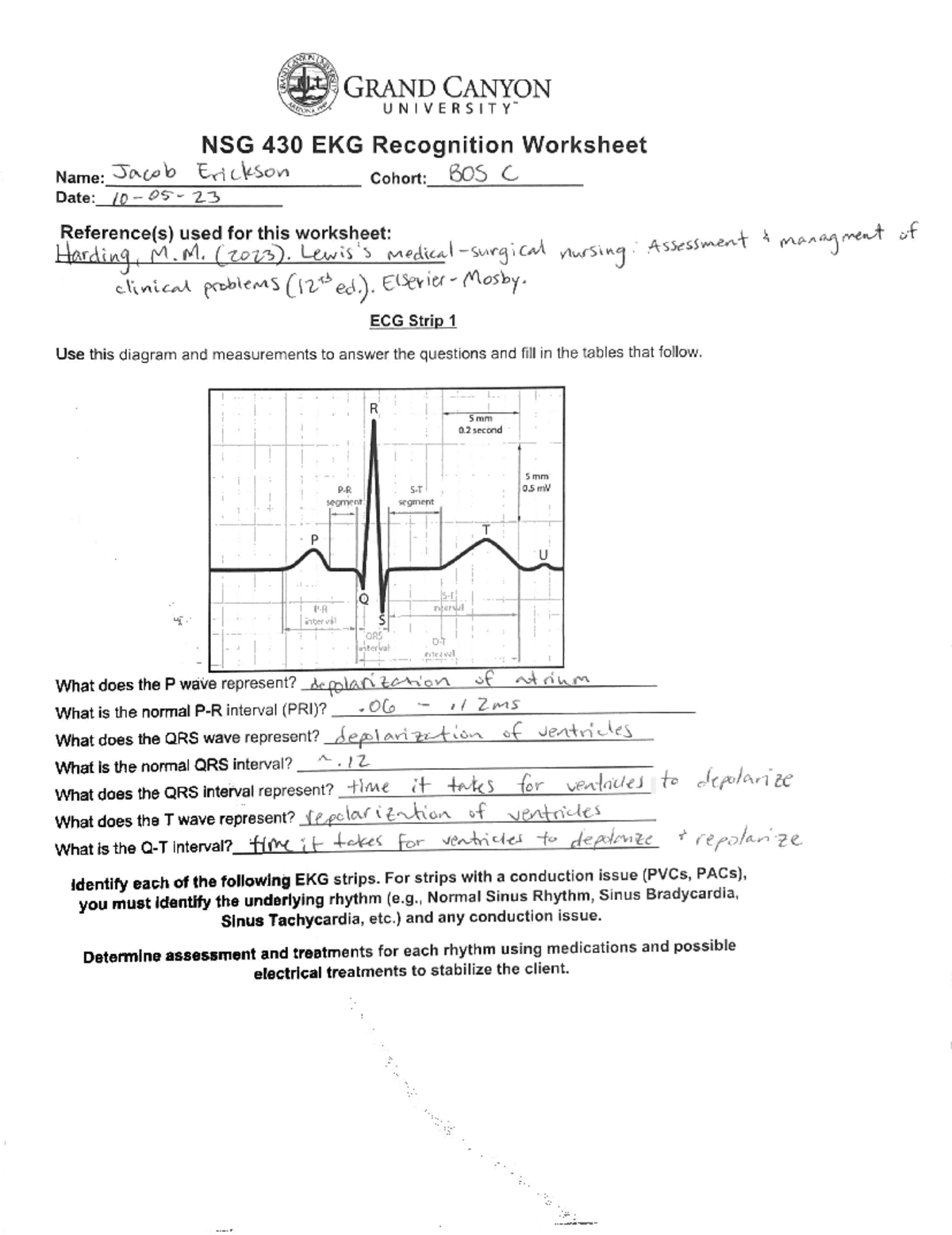 2202 Practice EKG Worksheet - BIO202 - Studocu