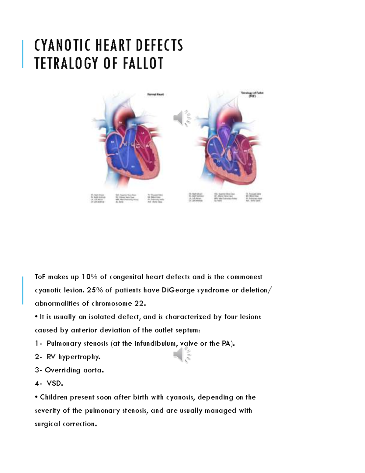 Cyanotic Heart Defects Tetralogy OF Fallot - CYANOTIC HEART DEFECTS ...