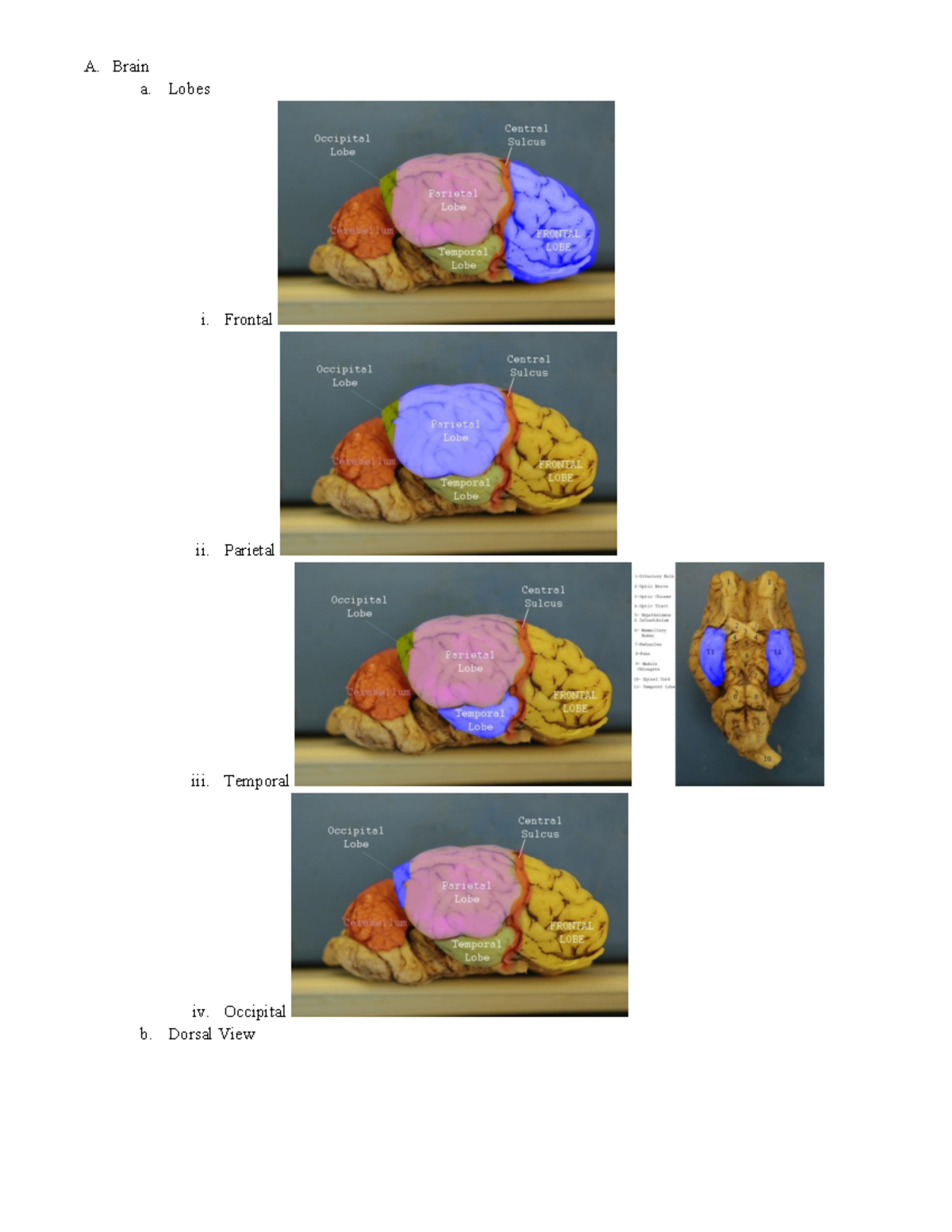 Practical 2 Study Guide - A. Brain a. Lobes i. Frontal ii. Parietal iii ...