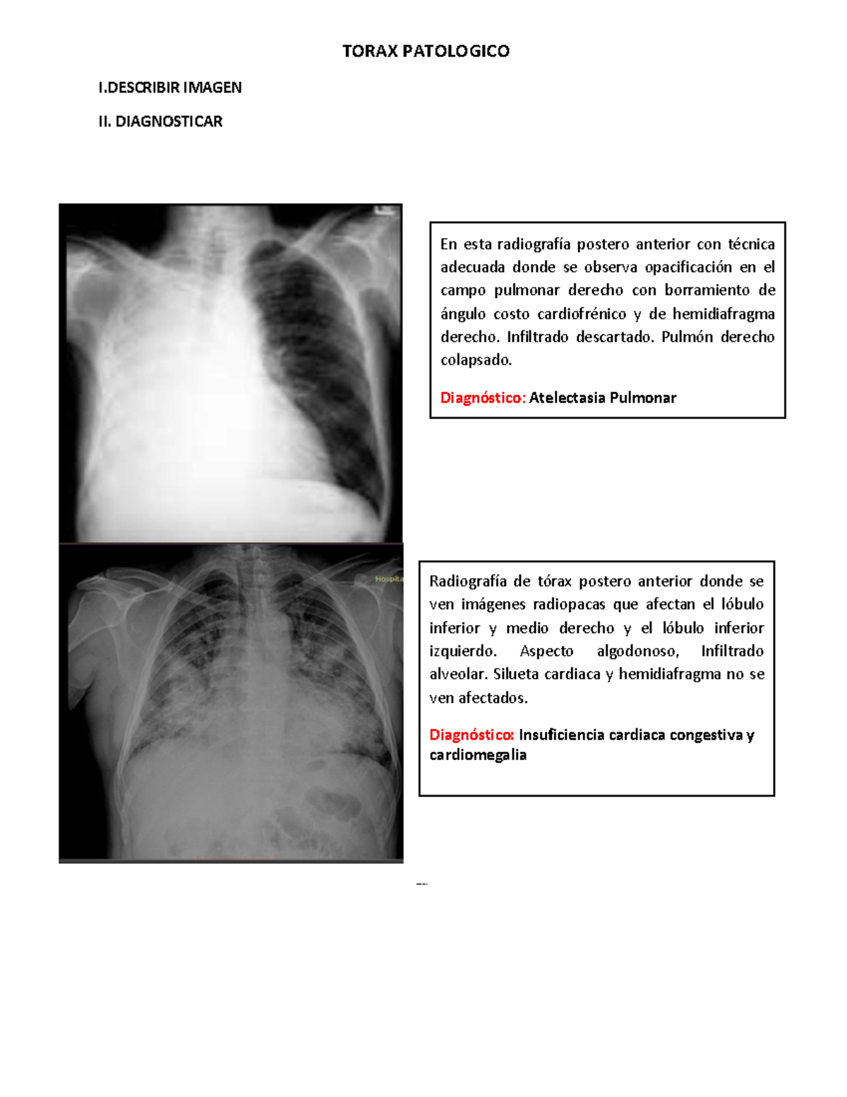 Torax Patologico - excelente - TORAX PATOLOGICO I IMAGEN II ...
