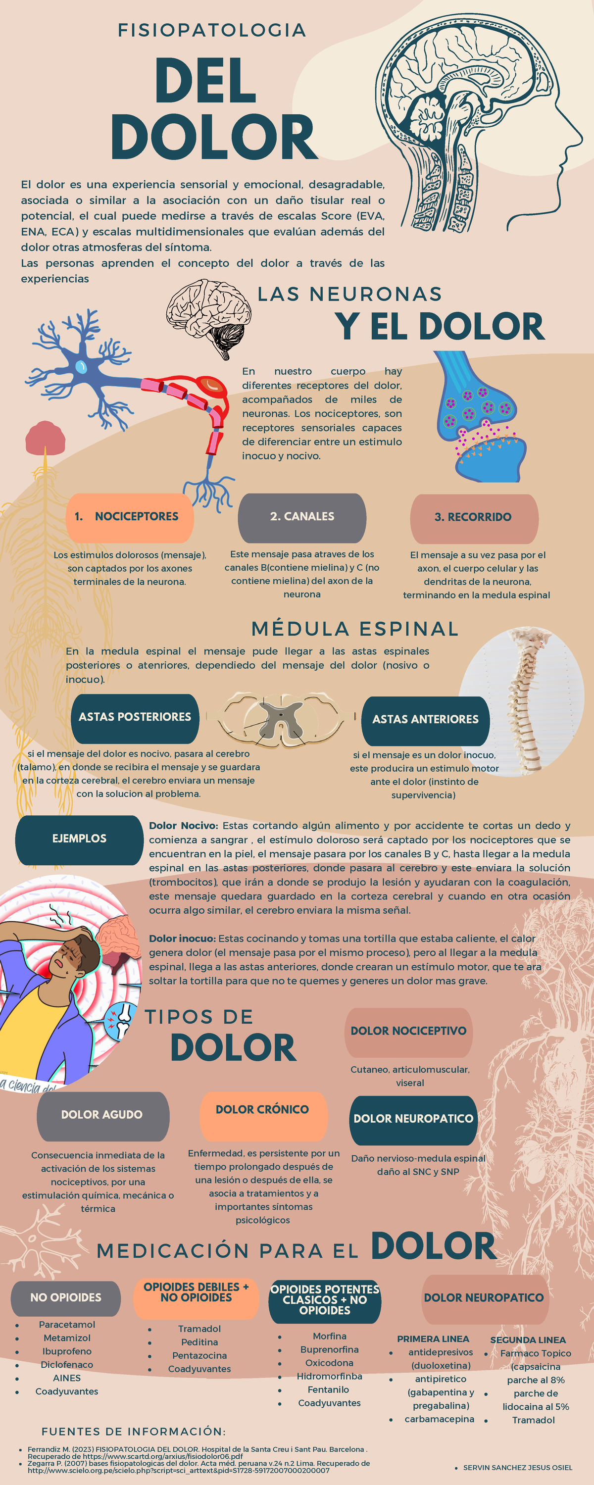 Infografia fisiopatologia del dolor - 2. CANALES 3. RECORRIDO EJEMPLOS DOLOR CRÓNICO ASTAS - Studocu