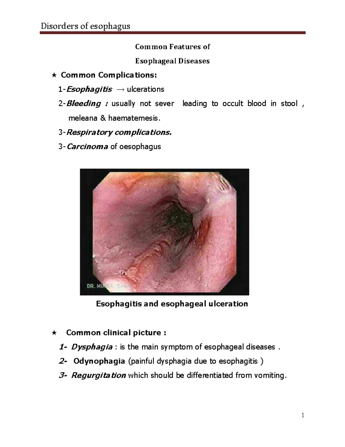 Common features of diseases of esophagus - Common Features of ...