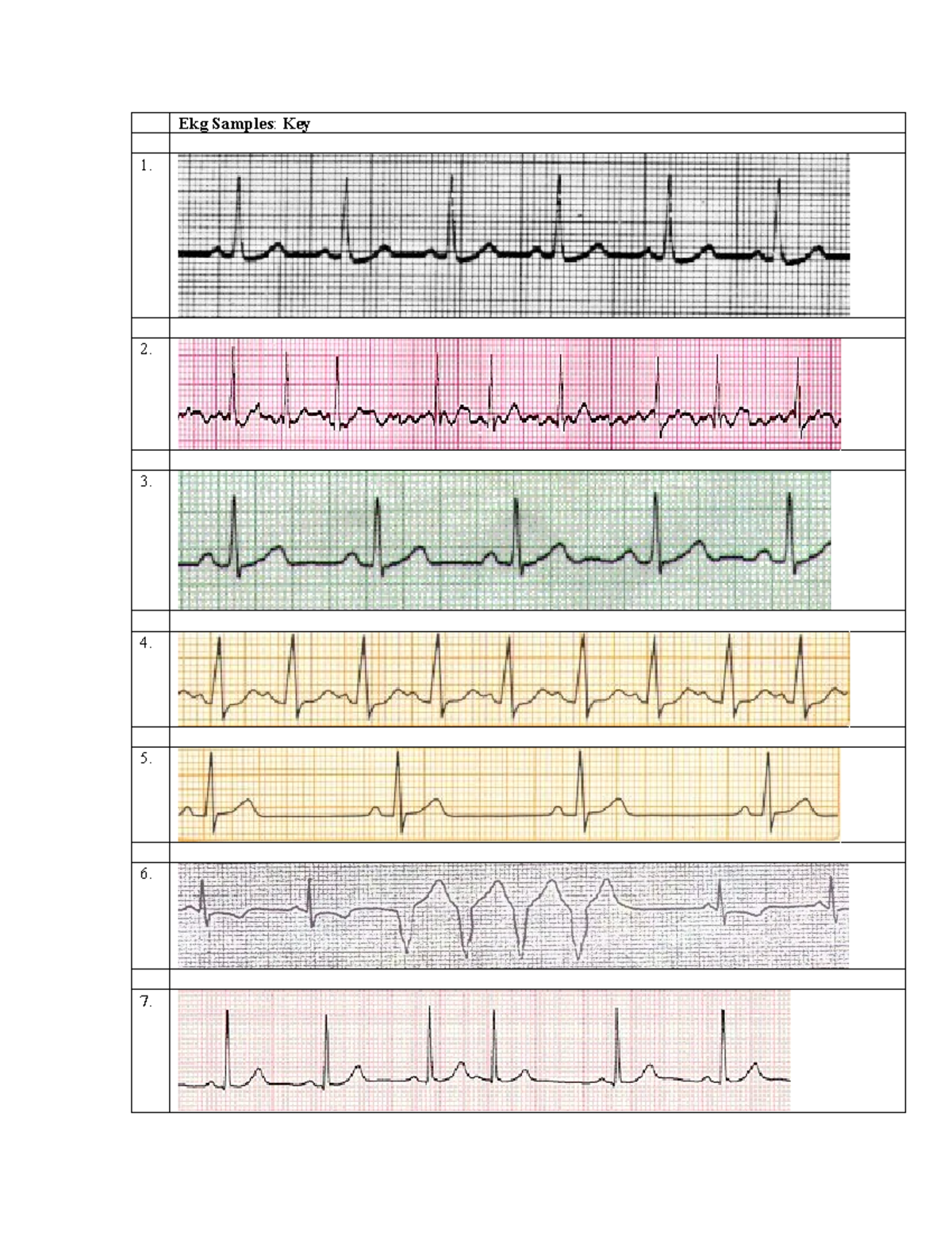 Ekg Samples - NRS 210 - 2. 3. 4. 5. 6. 8. 9. 10. 11. 12. 13. ) 21. 22 ...