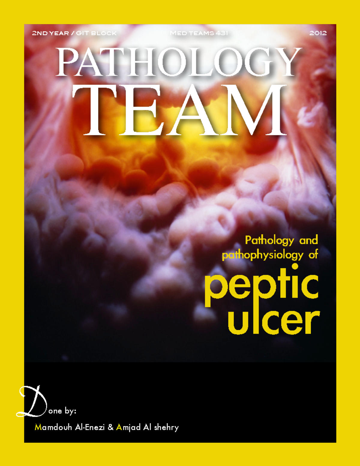Peptic ulcer disease - PATHOLOGY TEAM 2nd year / GIT block Med teams ...