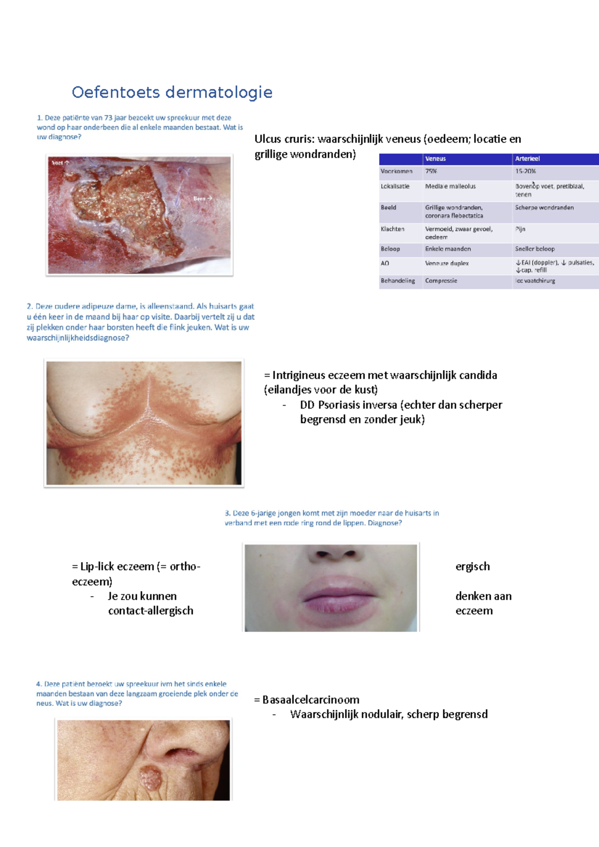 Oefentoets dermatologie - Oefentoets dermatologie Ulcus cruris ...