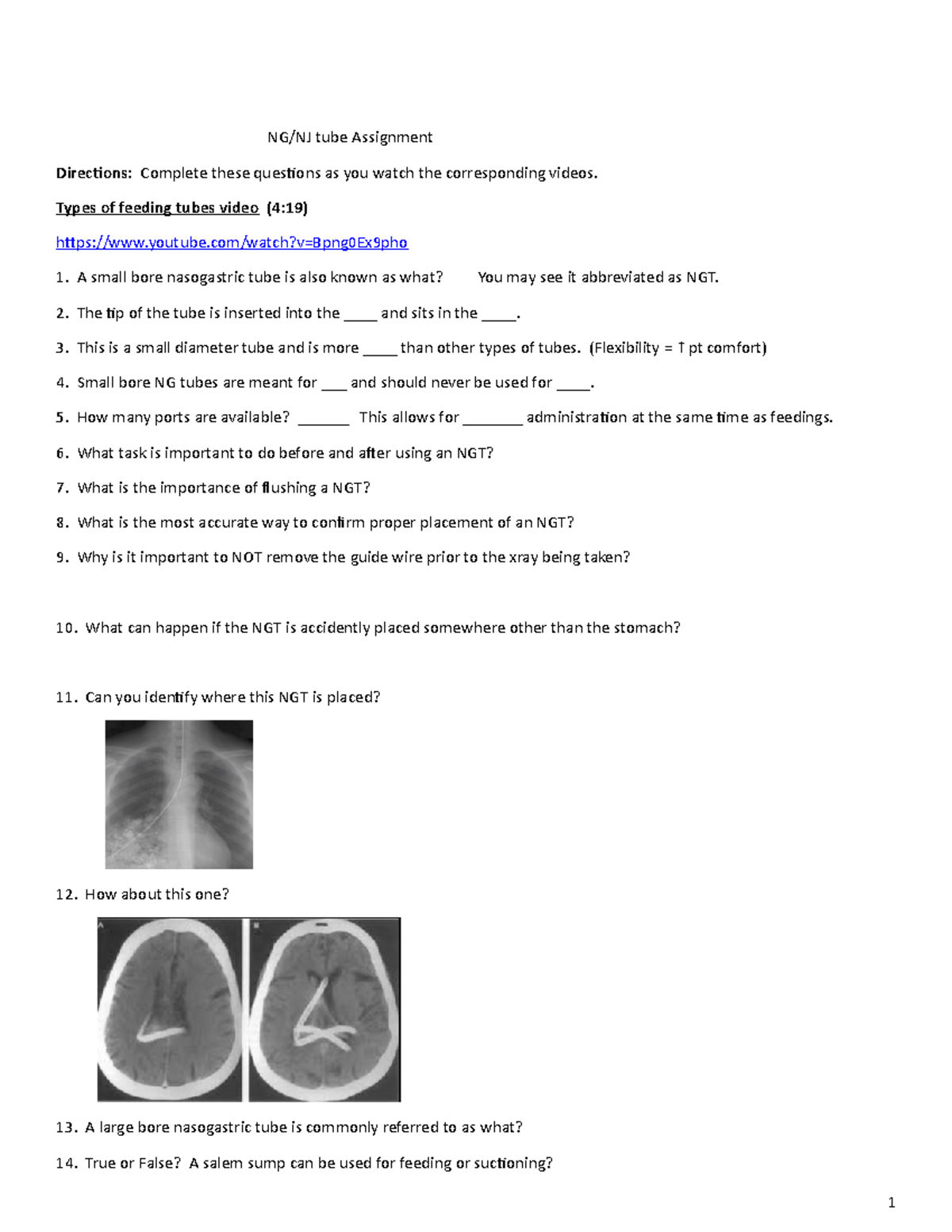NG NJ tube worksheet Student copymnnsdfnsdf,msdnfm,nsdm,fn s,dmnfms,dnf ...