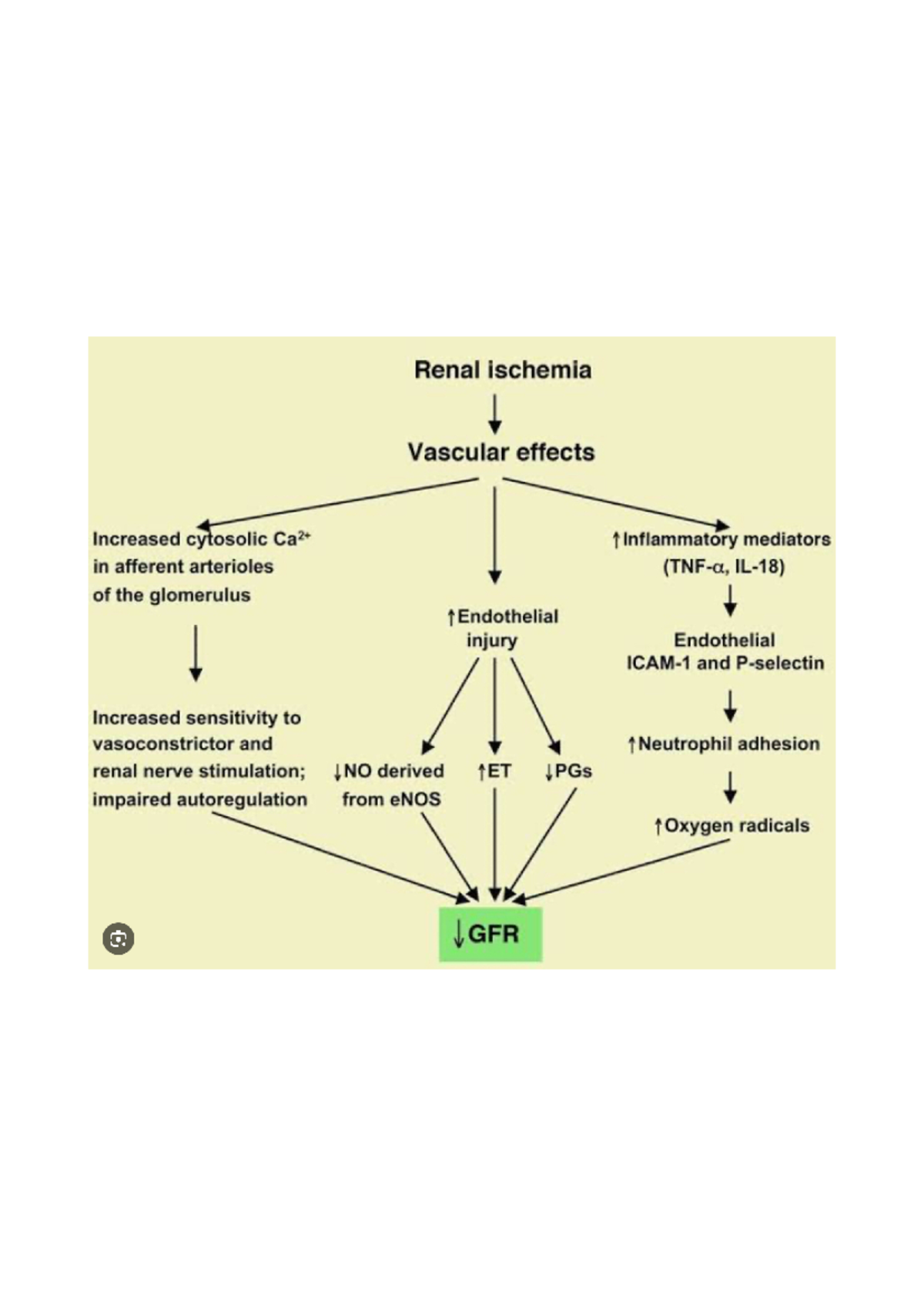 Pathology of ARF - For nursing - Renal ischemia Vascular effects ...