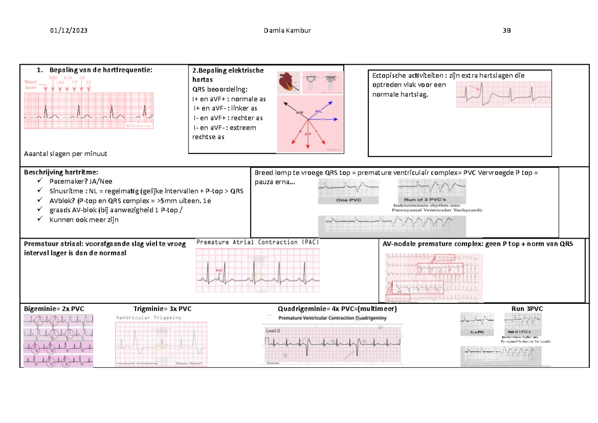 Spiekbrief ECG Damla Kambur - 01 /1 2 /2023 Damla Kambur 3B Bepaling ...
