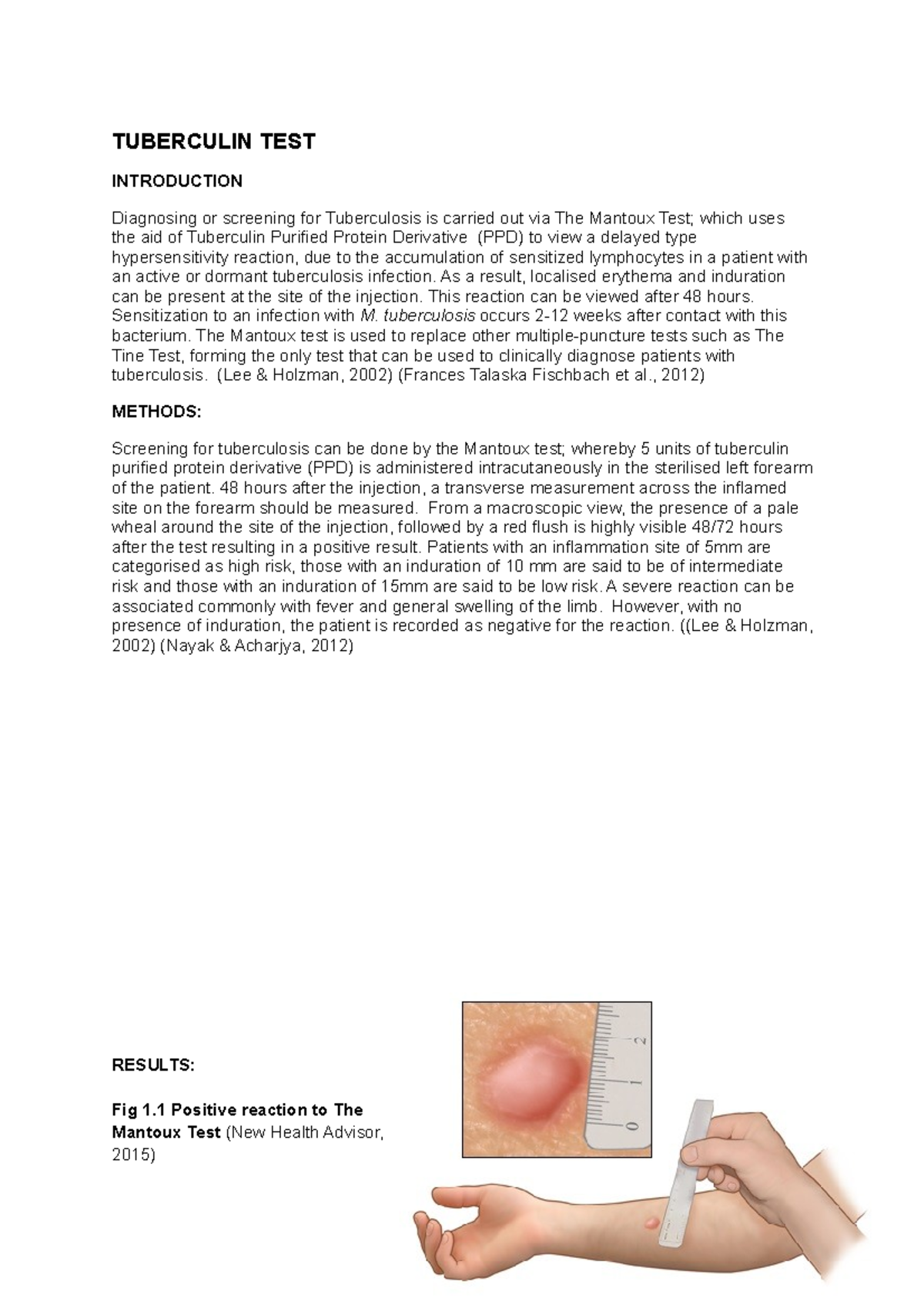 Positive Mantoux Results