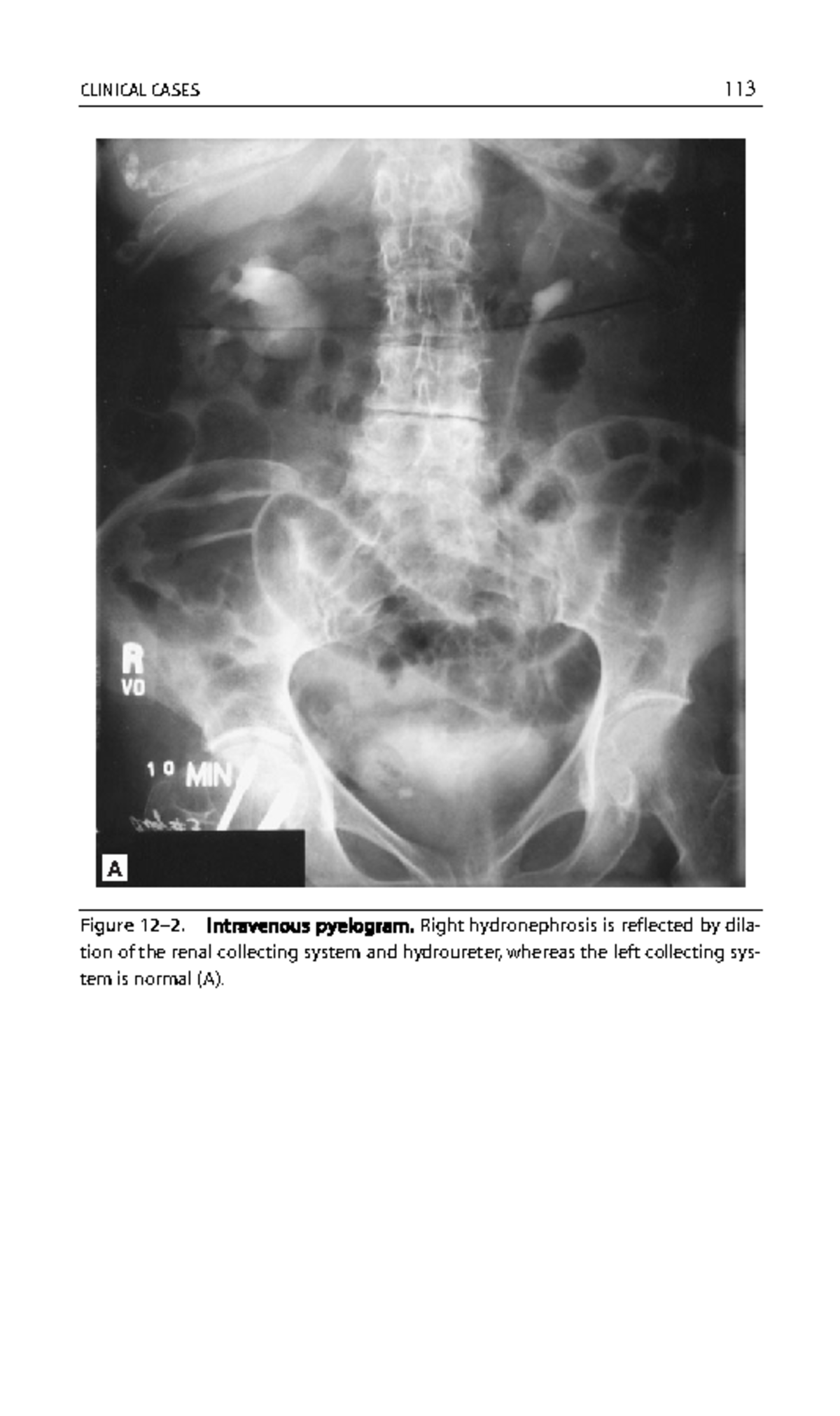 Case Files Obstetrics Gynecology Lecture Notes ed-54387147-20 ...