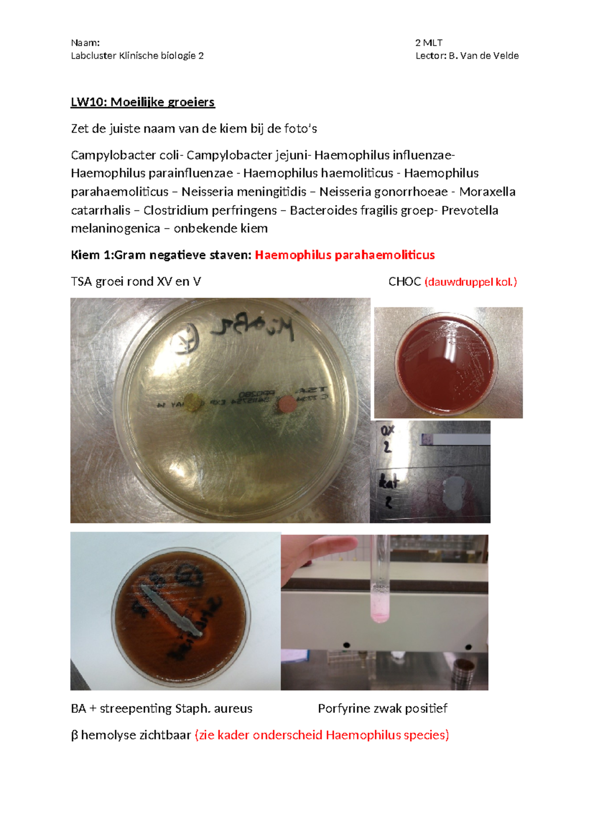 Verbetersleutel Moeilijke groeiers - Labcluster Klinische biologie 2 Lector: B. Van de Velde ...