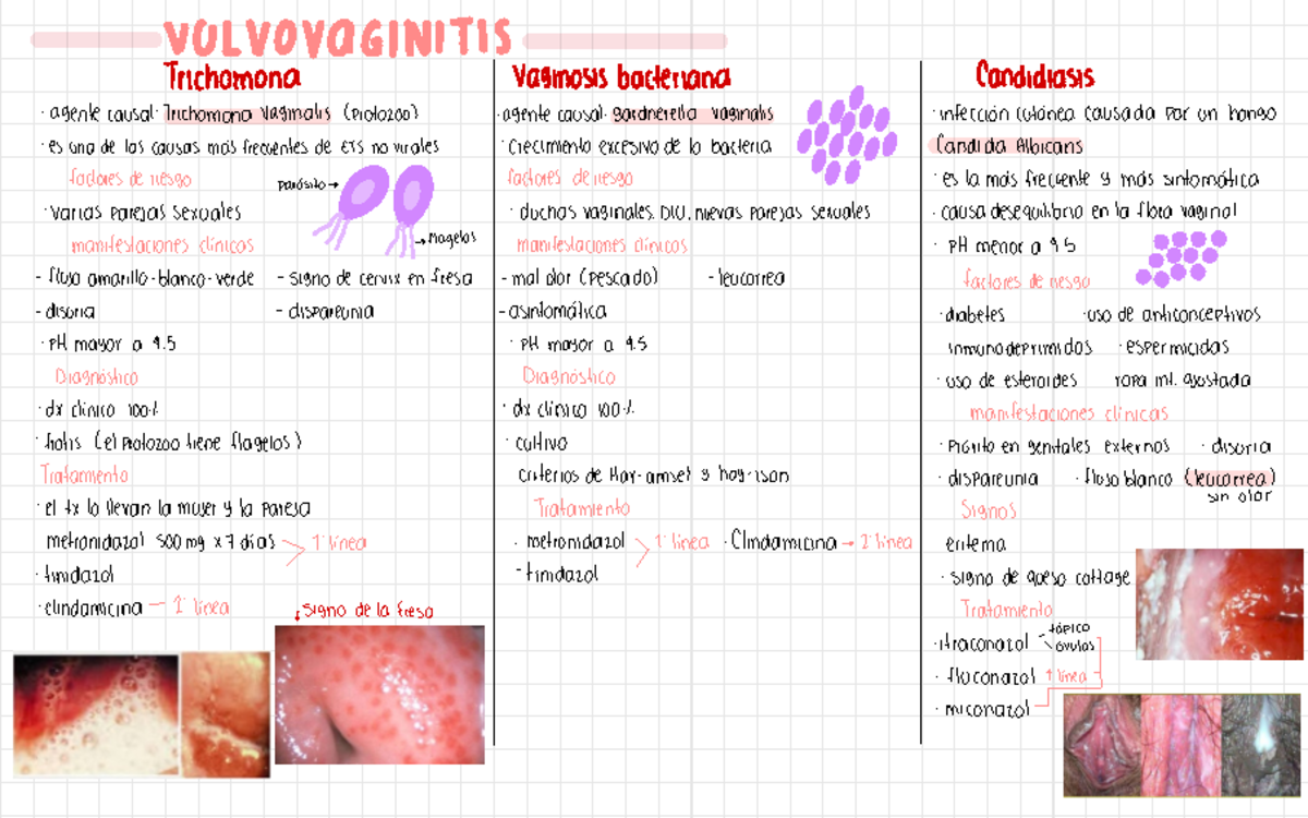 Vulvovaginitis - VULVOVOGINITIS Trlchomona VAOIMOSIS bacteriana ...