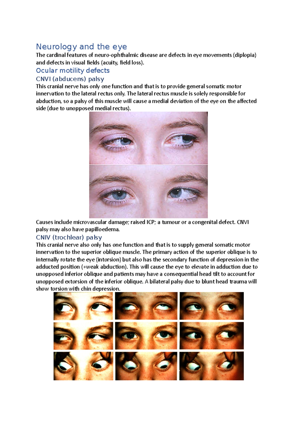 Neurology and the eye - Lecture notes 1 - Neurology and the eye The ...