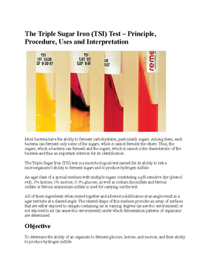 Urease Test - Lab - Urease Test- Principle, Media, Procedure and Result ...