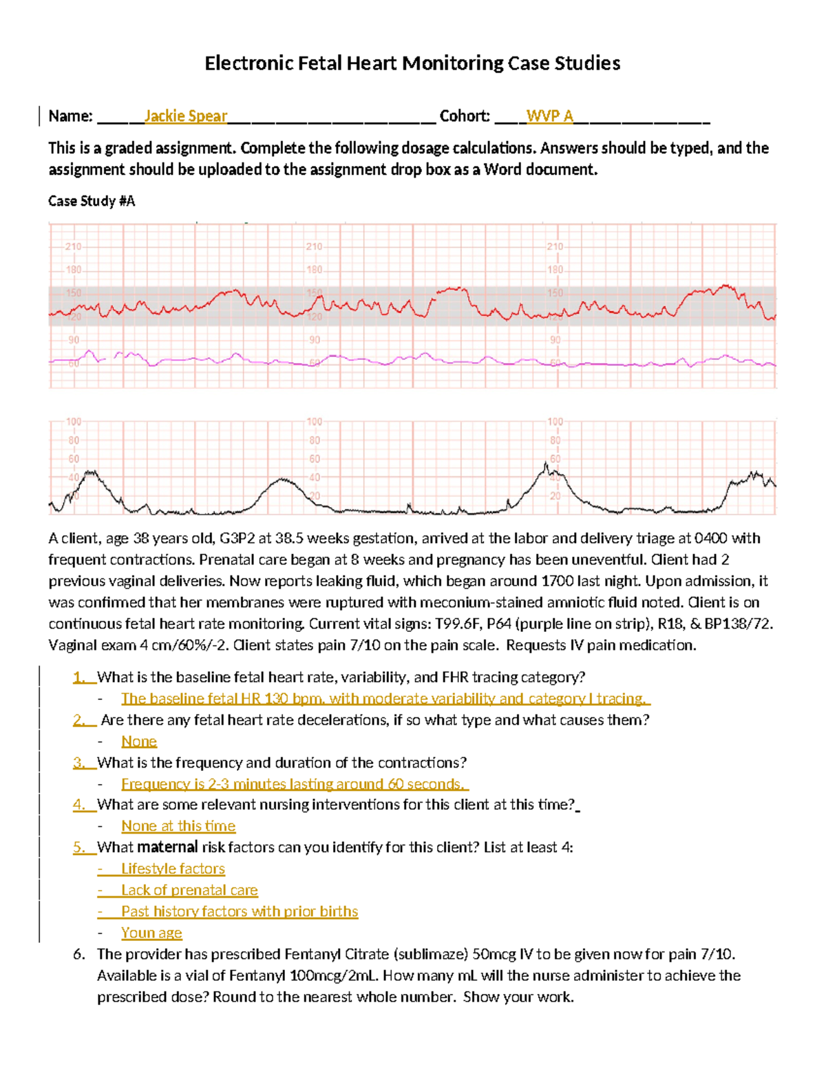 EFM Case Study SU-2 Student Version - Electronic Fetal Heart Monitoring ...
