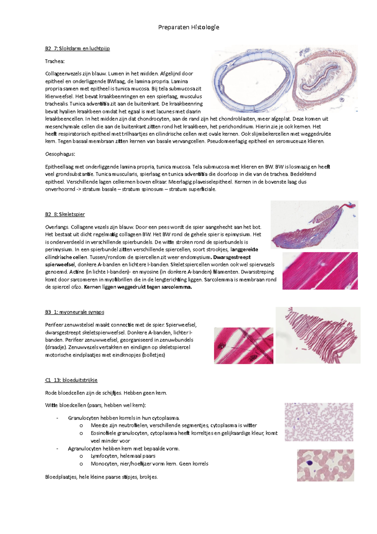 Preparaten - B2_7: Slokdarm en luchtpijp Trachea: Collageenvezels zijn ...