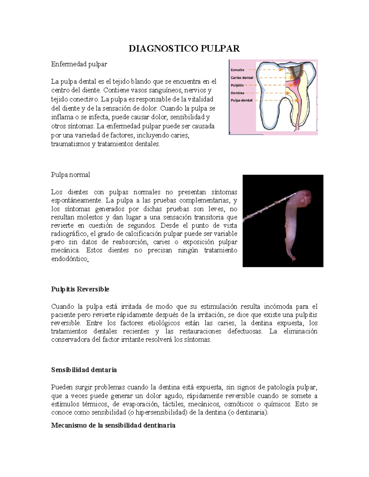 Diagnostico Pulpar - DIAGNOSTICO PULPAR Enfermedad pulpar La pulpa dental es el tejido blando ...