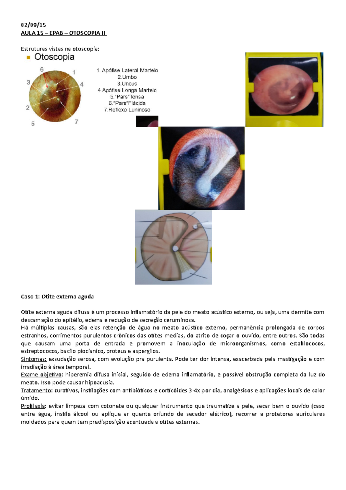 AULA 15 epab Otoscopia II - 02/09/ AULA 15 – EPAB – OTOSCOPIA II ...