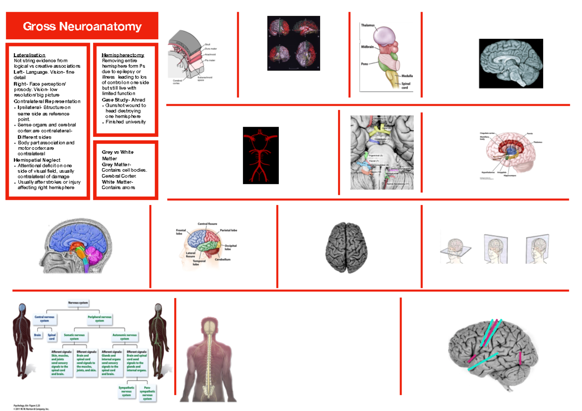 Gross neuroanatomy - Some notes with lots of diagrams so you can add ...