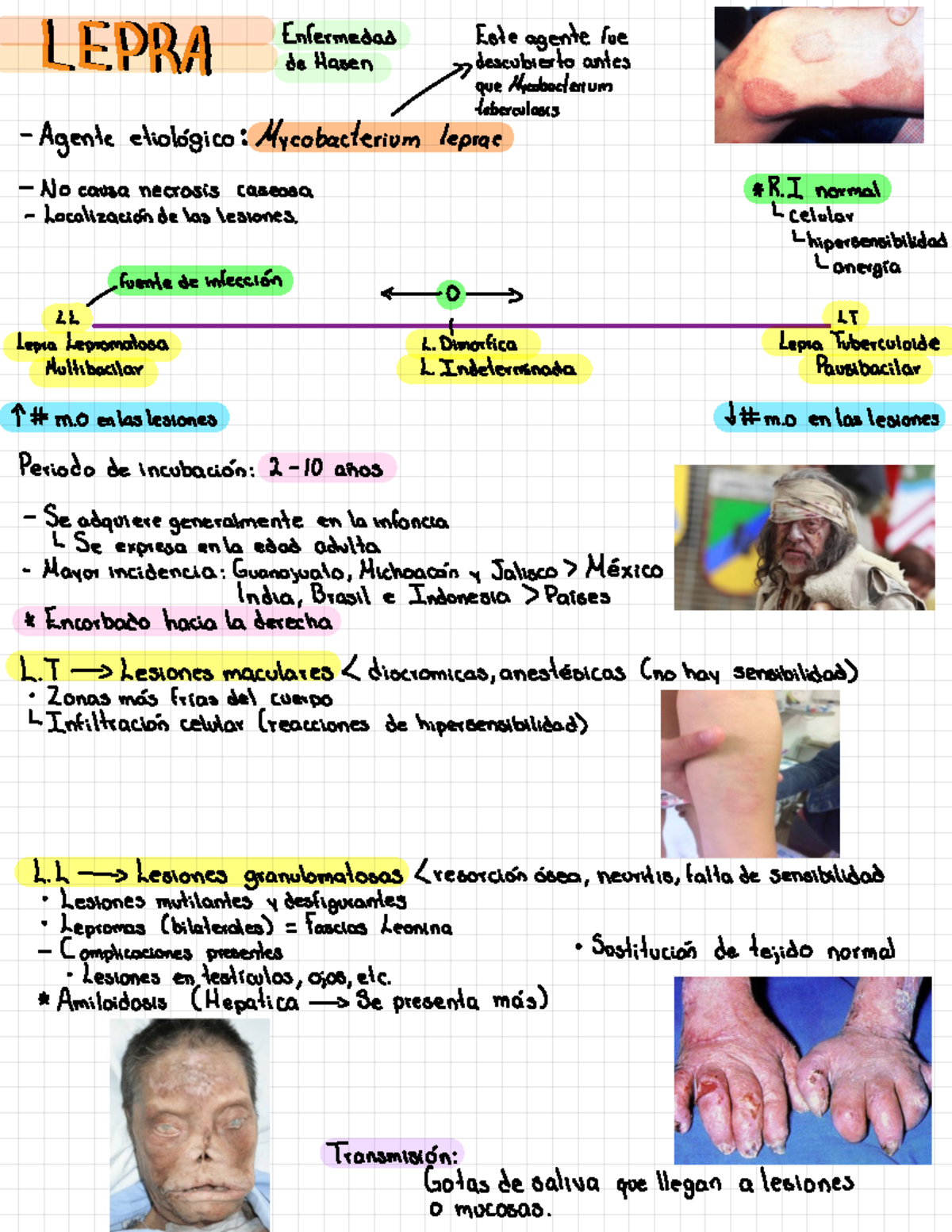 Lepra - Antonio Murguía - Enfermedad Este agente fue LEPRA de Hasen ...