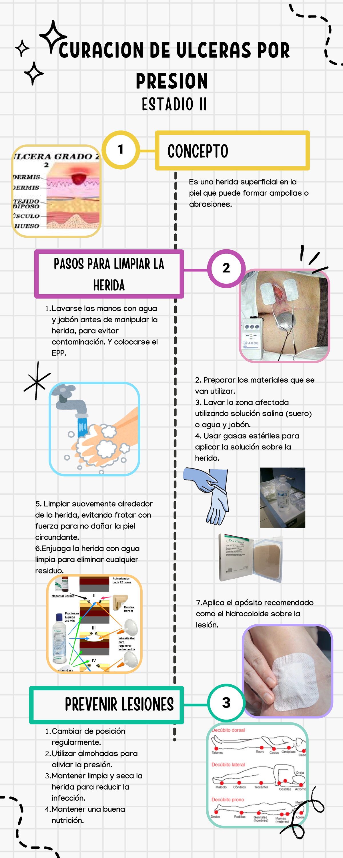 Curacion DE Ulceras POR Presion- Estadio II - 3 1 2 CURACION DE ULCERAS ...