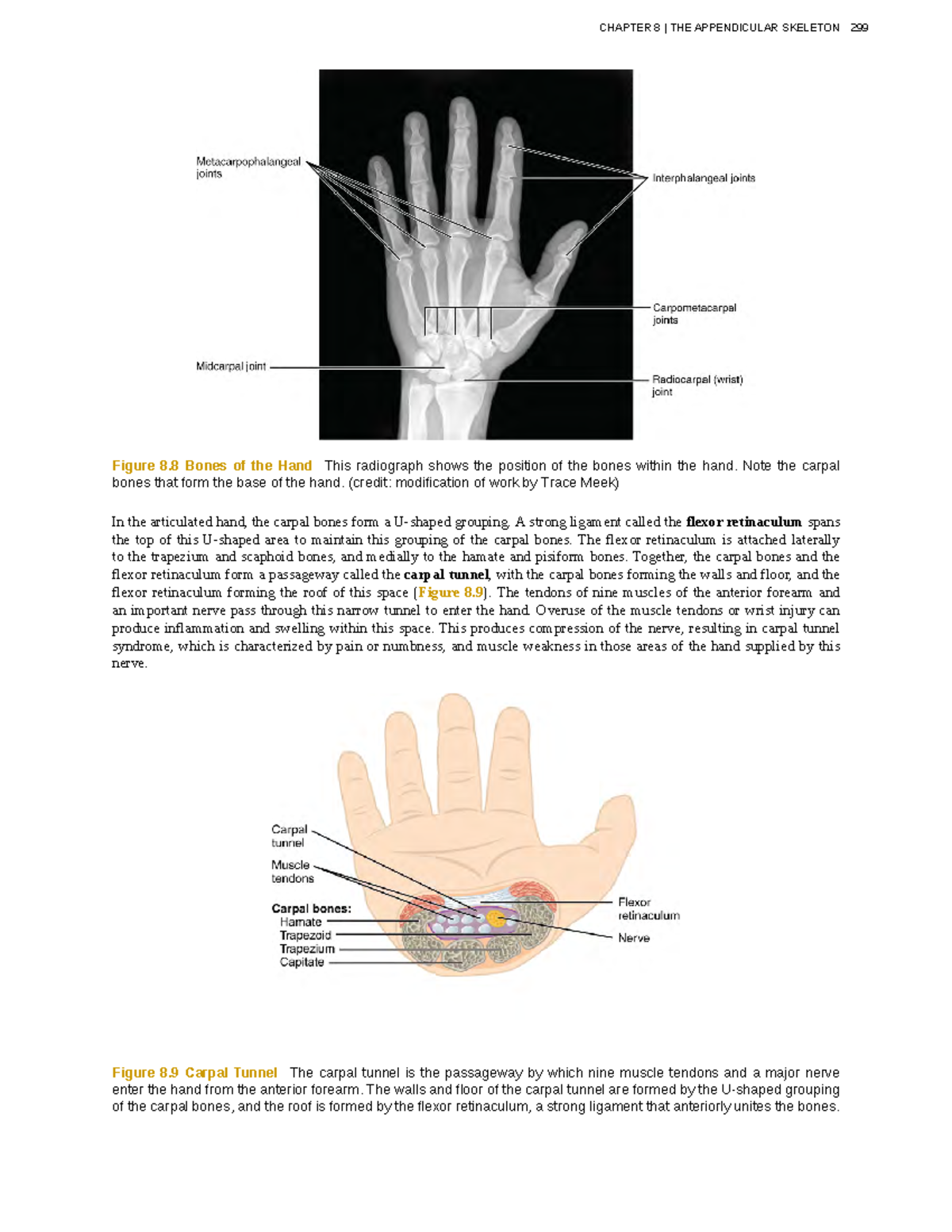 Anatomy-physiology-103 - Figure 8 Bones of the Hand This radiograph ...