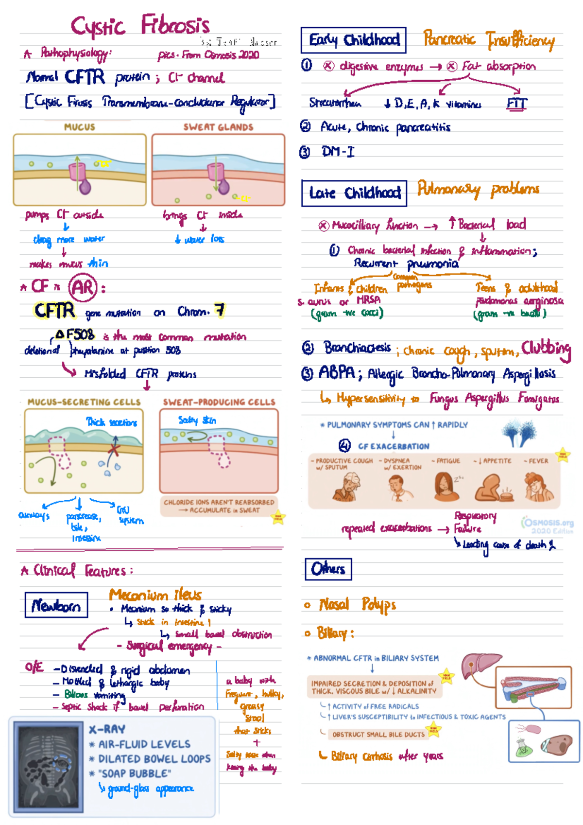 Cystic fibrosis - for pediatric rotation from sunflower book ...