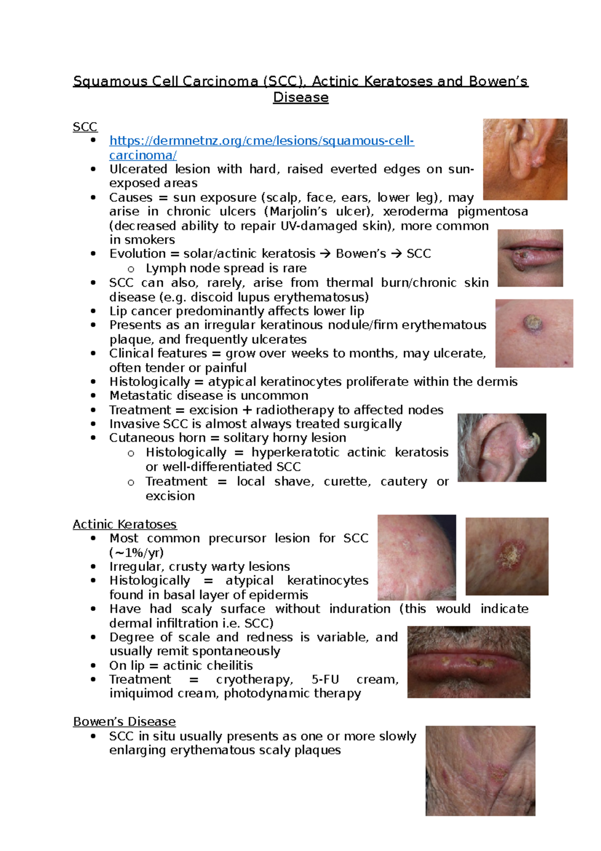 SCC, AK and Bowen's Disease - Squamous Cell Carcinoma (SCC), Actinic ...