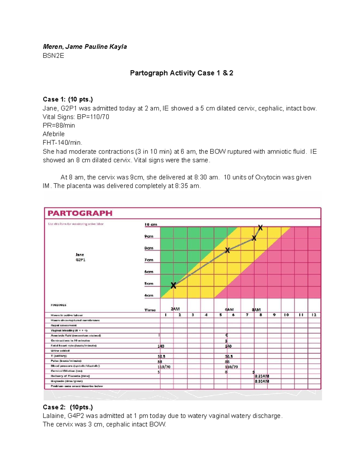 Meren BSN2E Partograph - Meren, Jame Pauline Kayla BSN2E Partograph ...