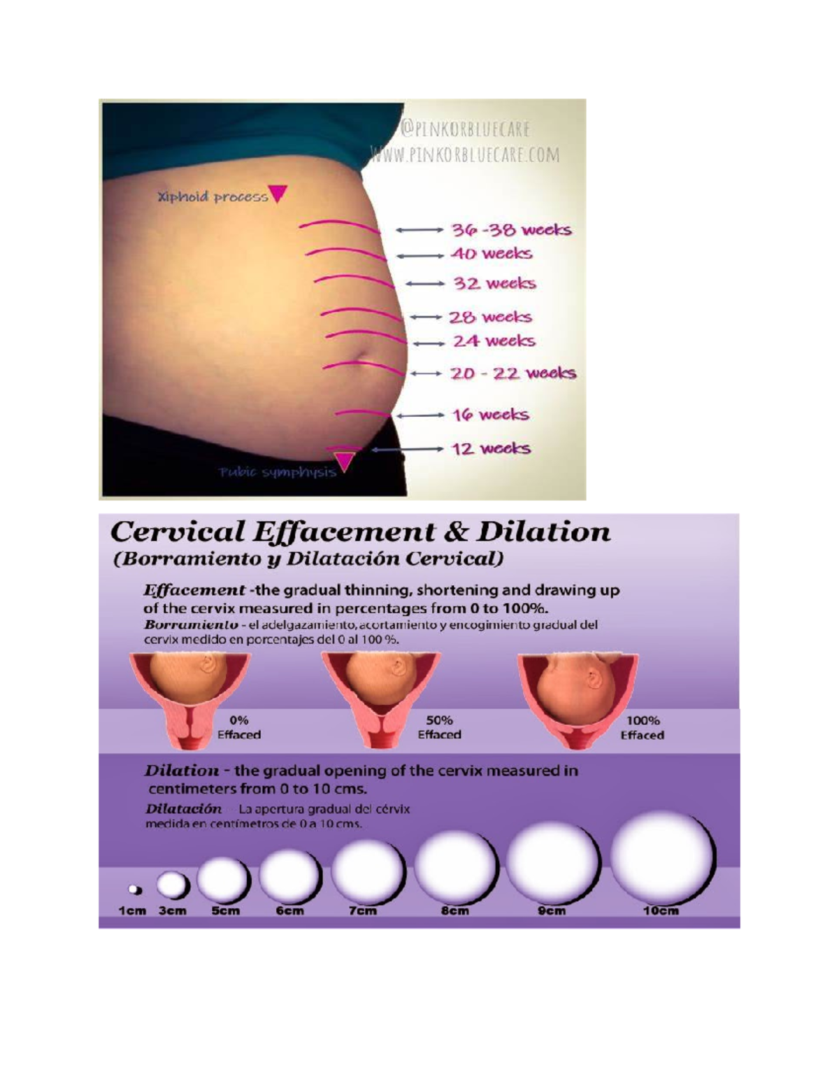 OB slides - 3 Parameters to measure the contraction Frequency: How ...