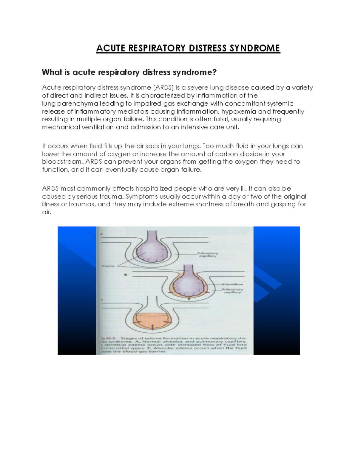 Acuterespiratorydistresssyndrome - ACUTE RESPIRATORY DISTRESS SYNDROME ...