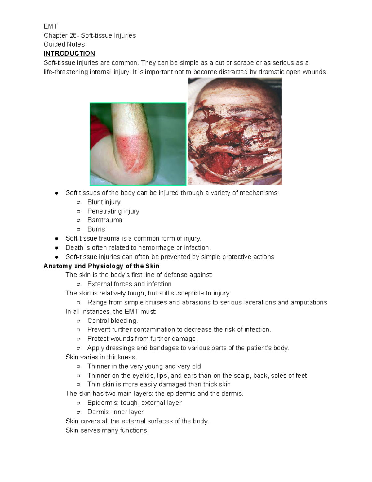 Copy of EMT Chapter 26- Soft-tissue Injuries Guided Notes - Chapter 26 ...
