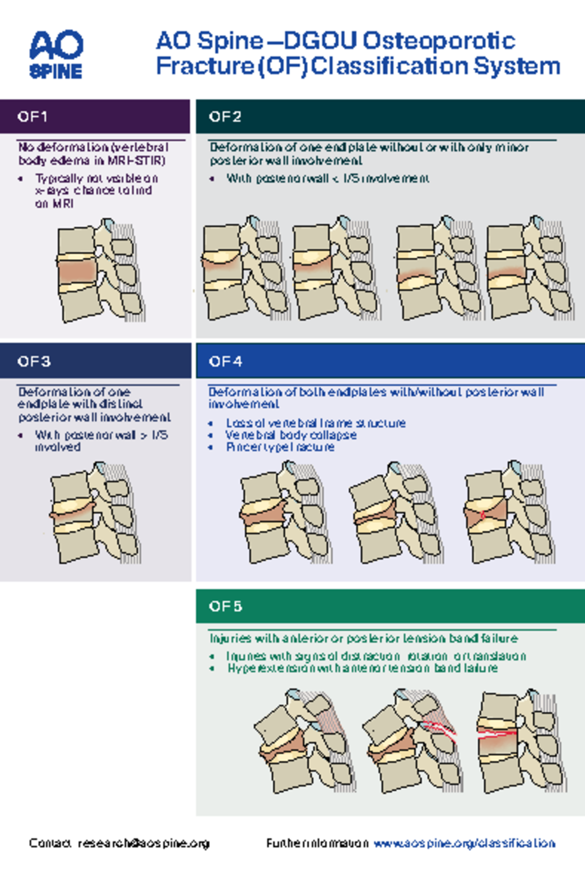 Ao Spine Osteoporotic Classification Pocket Card Ao Spine—dgou
